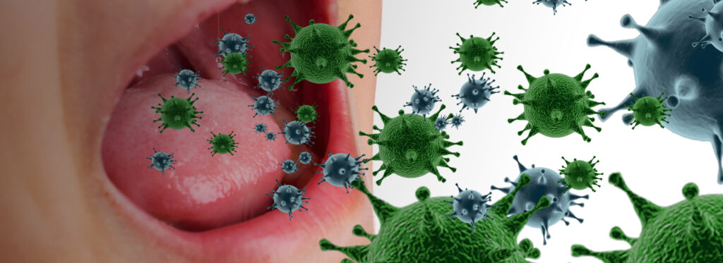 Pyorrhoea treatment – Meraki Dental Studio