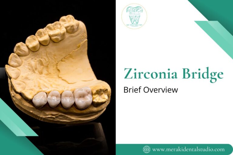 Zirconia Bridge South Delhi – Meraki Dental Studio